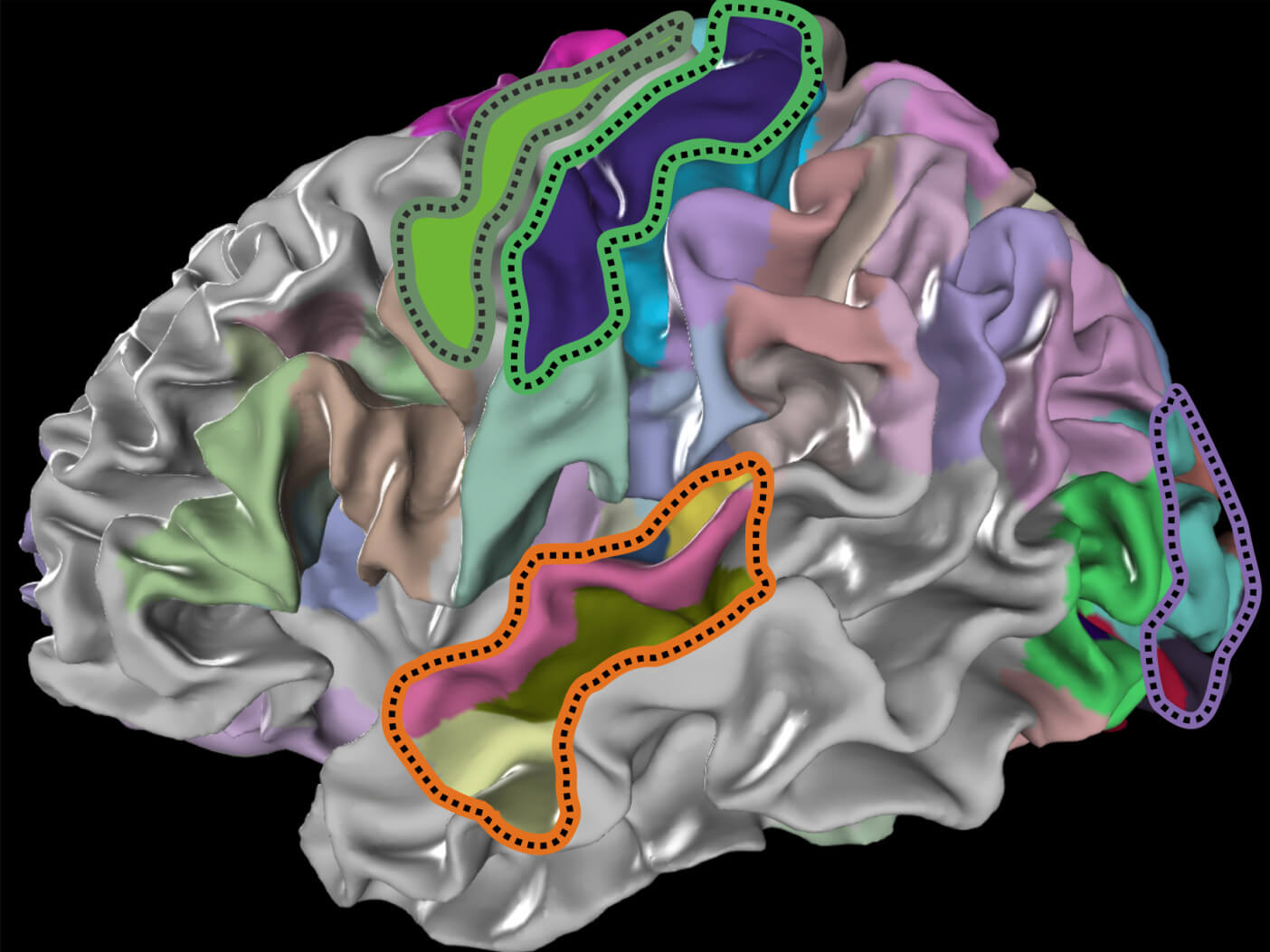 New Analysis Provides Comprehensive Insights into the Human Brain’s ...